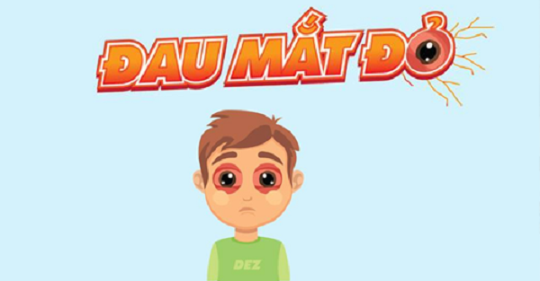 Điều trị đau mắt đỏ ở trẻ em an toàn, nhanh khỏi, không biến chứng